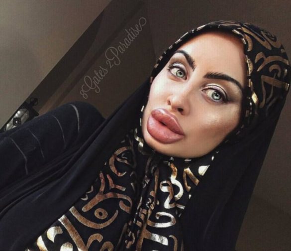 World Record Breaker: She Has the Biggest Lips in the World! - Demotix.com