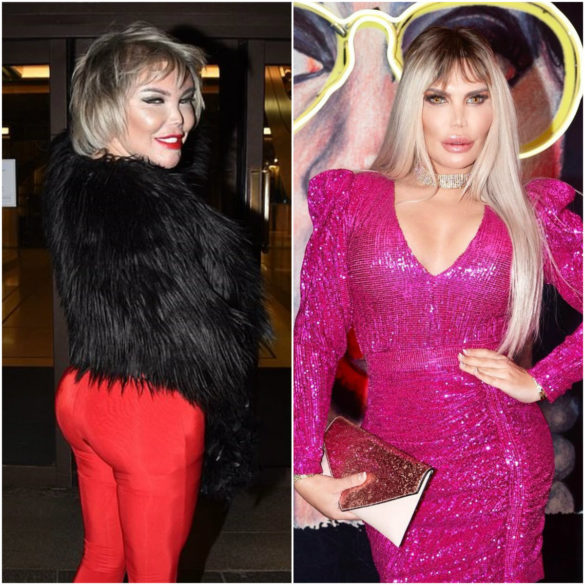 Roddy Alves Shows Short Natural Hair After Painful Face Feminization ...