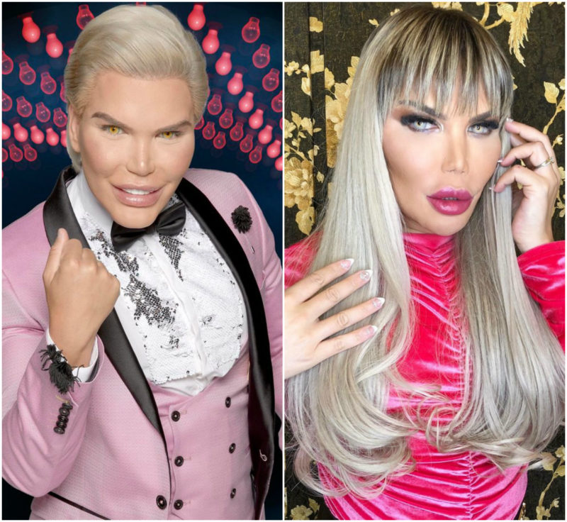 Roddy Alves Shows Short Natural Hair After Painful Face Feminization ...