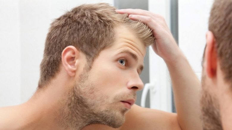 Early Signs of Balding: Causes, Symptoms, Tips and Treatment Options!