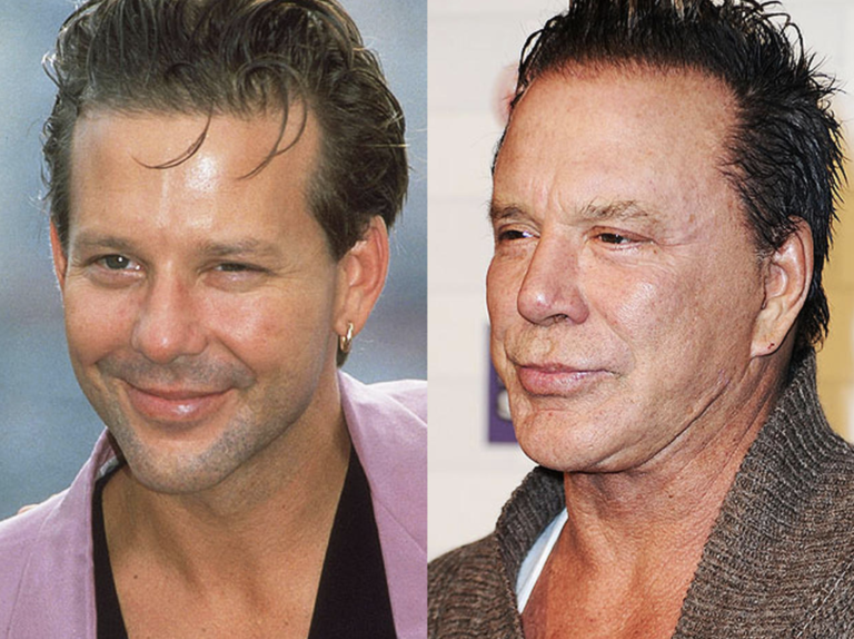 Mickey Rourke's Face Is Destroyed by Too Many Botched Plastic Surgeries ...