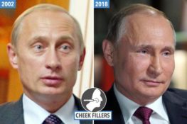 Plastic Surgeon Claims Putin Had These Surgeries - Demotix.com