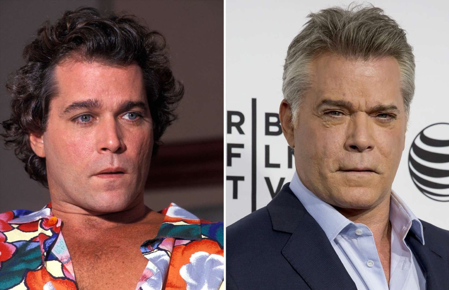 Ray Liotta Acne Scars