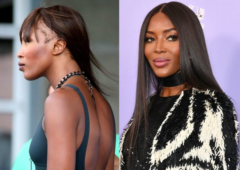 10 Celebrities Who Have Less Hair Than You Think - Demotix.com