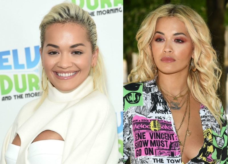 10 Celebrities Who Have Less Hair Than You Think - Demotix.com