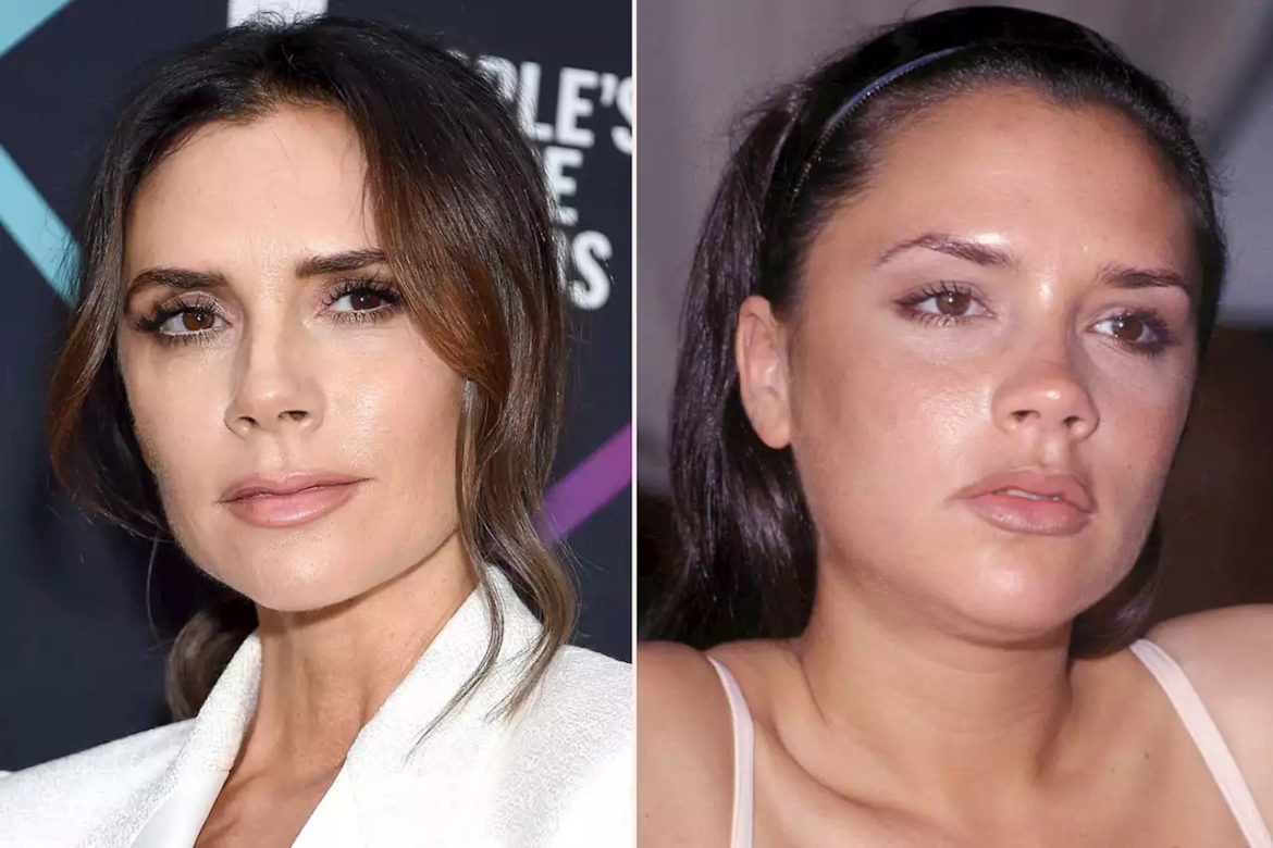 Celebrities Are Desperate for Botox Injections During the Lockdown ...