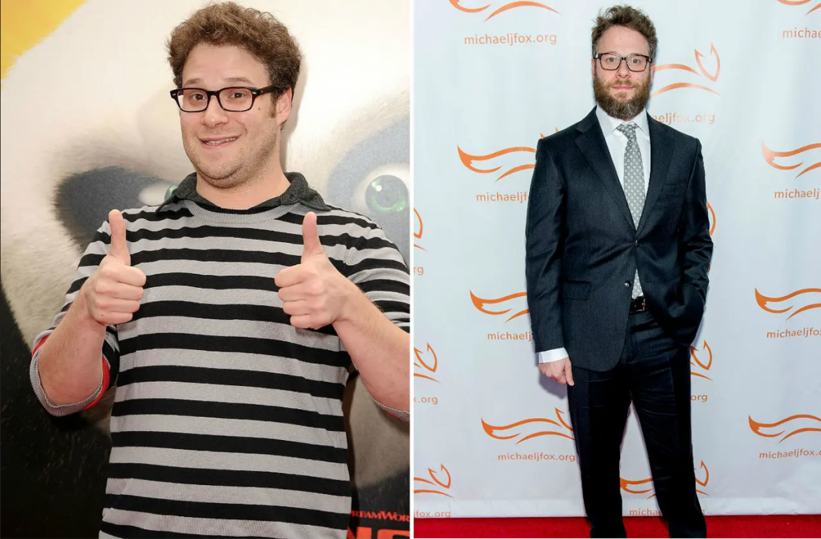Dramatic Celebrity Weight Loss Stories - Demotix.com