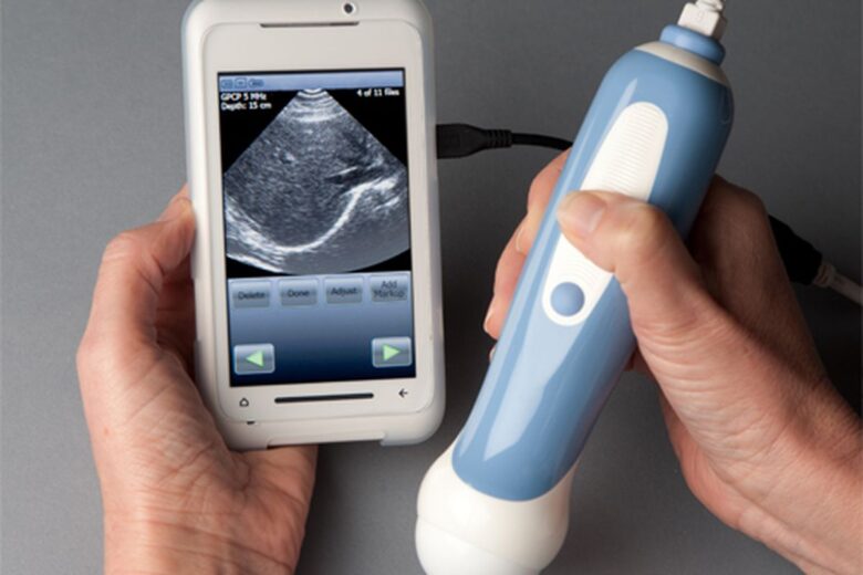 Benefits of Portable Ultrasound and its Benefit on the World of Healthcare